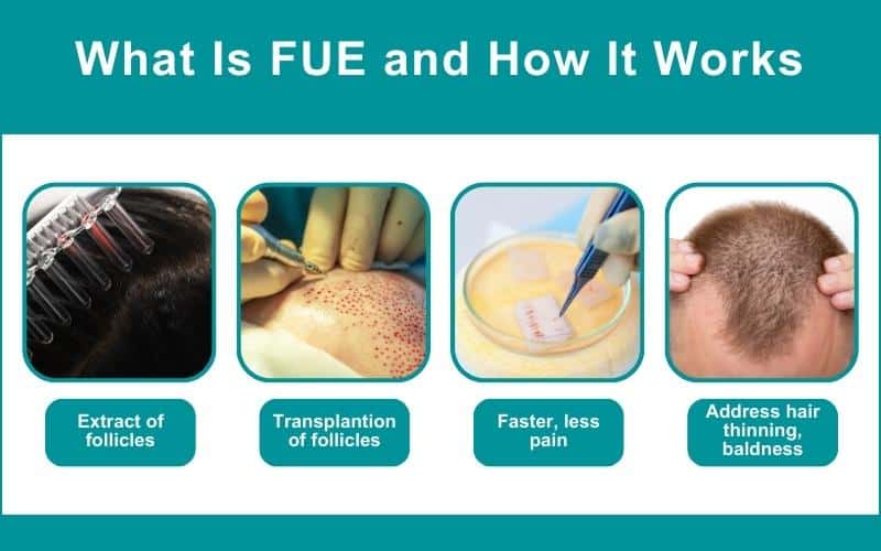 Can FUE Be Done Without Shaving? Find Out Now!