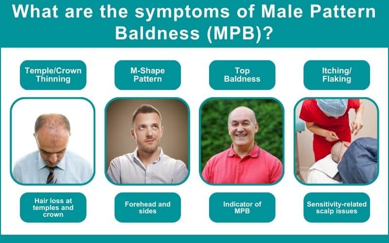 Uncovering the Mystery of Balding Genetics