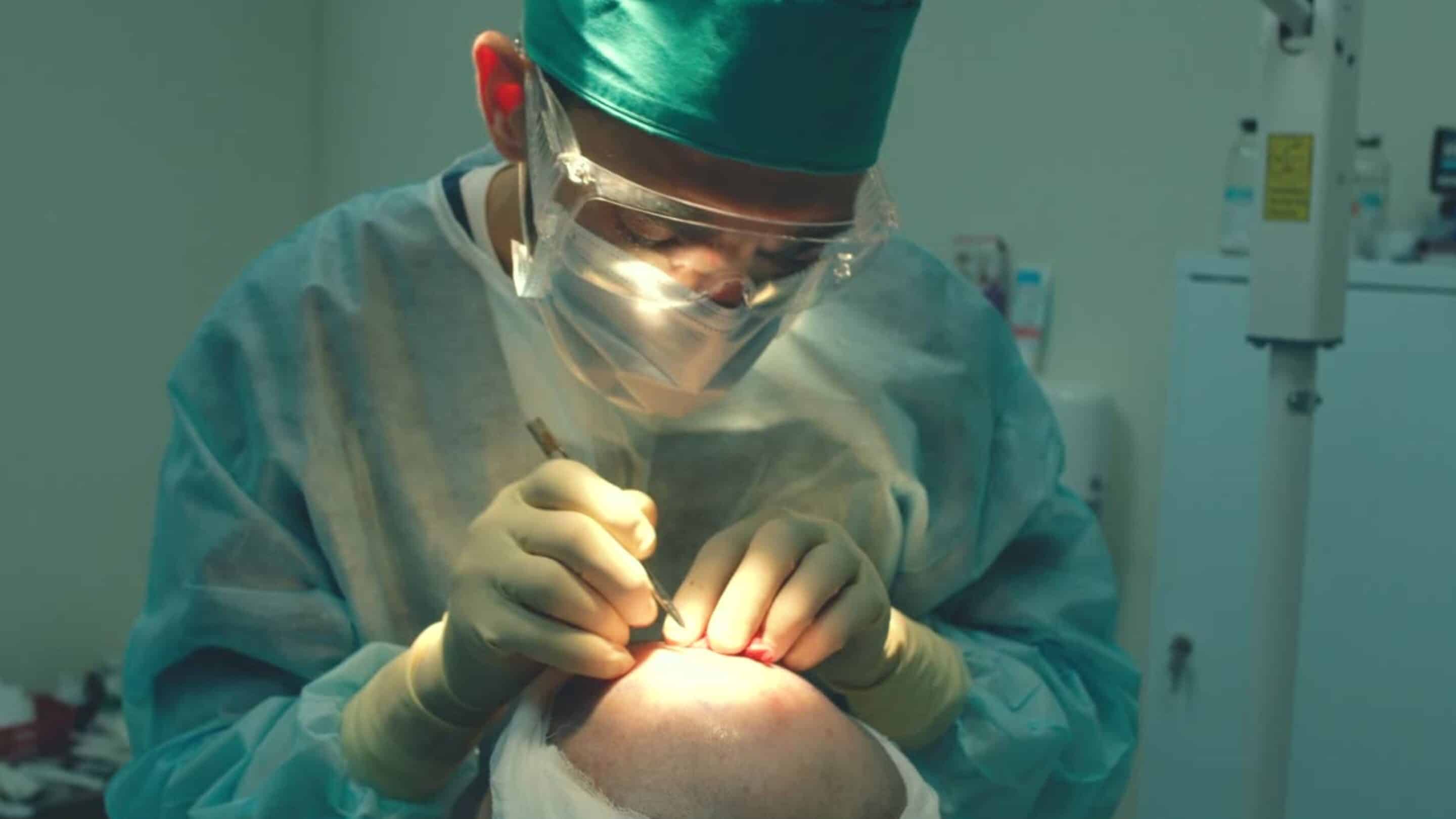 Finding the Best Cost for an FUE Hair Transplant: A Complete Guide